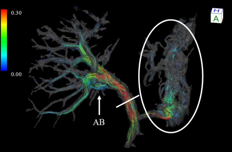 4D Flow MRI | Cardio Flow Design