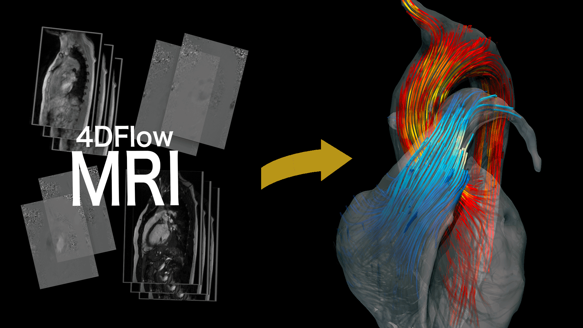 HOME | Cardio Flow Design